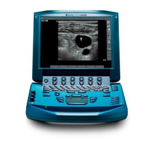 Sonosite Micromaxx Ultrasound Machine Featuring Wireless Data Transfer