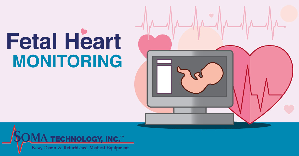 Fetal Heart Monitor - What is it? How Does it Work?